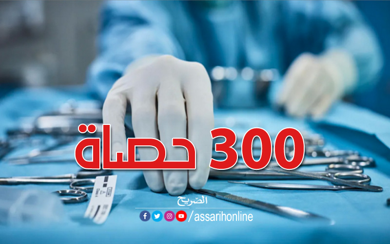 استخراج أكثر من 300 حصاة من مرارة مريضة – Assarih