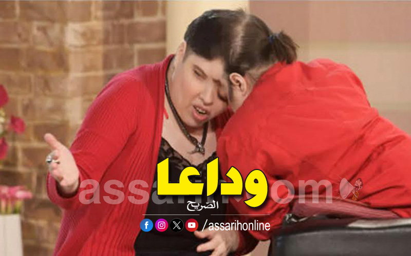 رحيل أكبر توأمين ملتصقين في العالم – Assarih