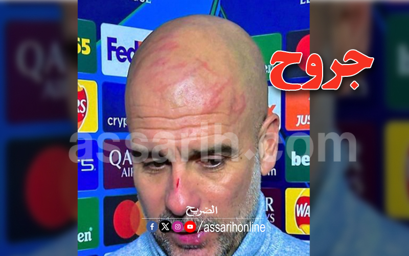 مفاجأة: جروح غوارديولا.. سببها ‘شاب جزائري’ (صور) – Assarih