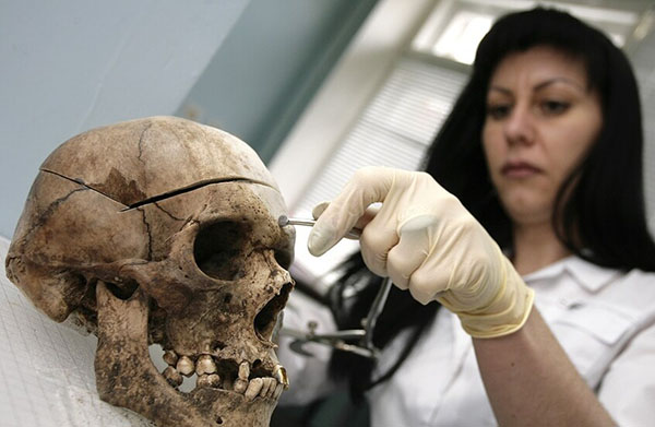 اكتشاف مُذهل: العثور على رفات جمجمة عمرها 4200 عام (صور) – Assarih